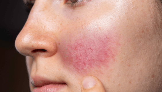 10 Most Common Skin Conditions & How To Relieve Them
